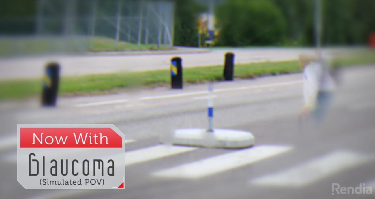 How to Spot Glaucoma Early: Symptoms & Eye Care Tips